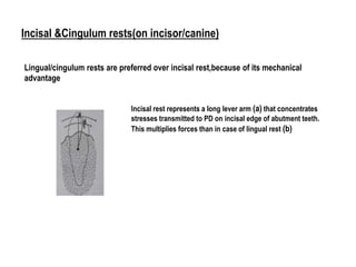 INDIRECT RETAINERS IN CAST PARTIAL DENTURES- Dr MEENU MERRY C PAUL | PPT