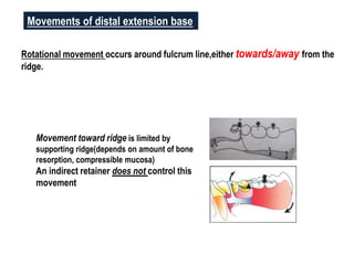 INDIRECT RETAINERS IN CAST PARTIAL DENTURES- Dr MEENU MERRY C PAUL | PPT