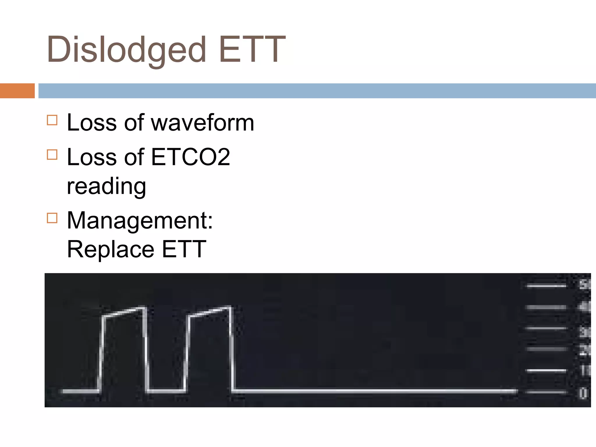 Etco2 in non-intubated patient: a must in ed | PPT