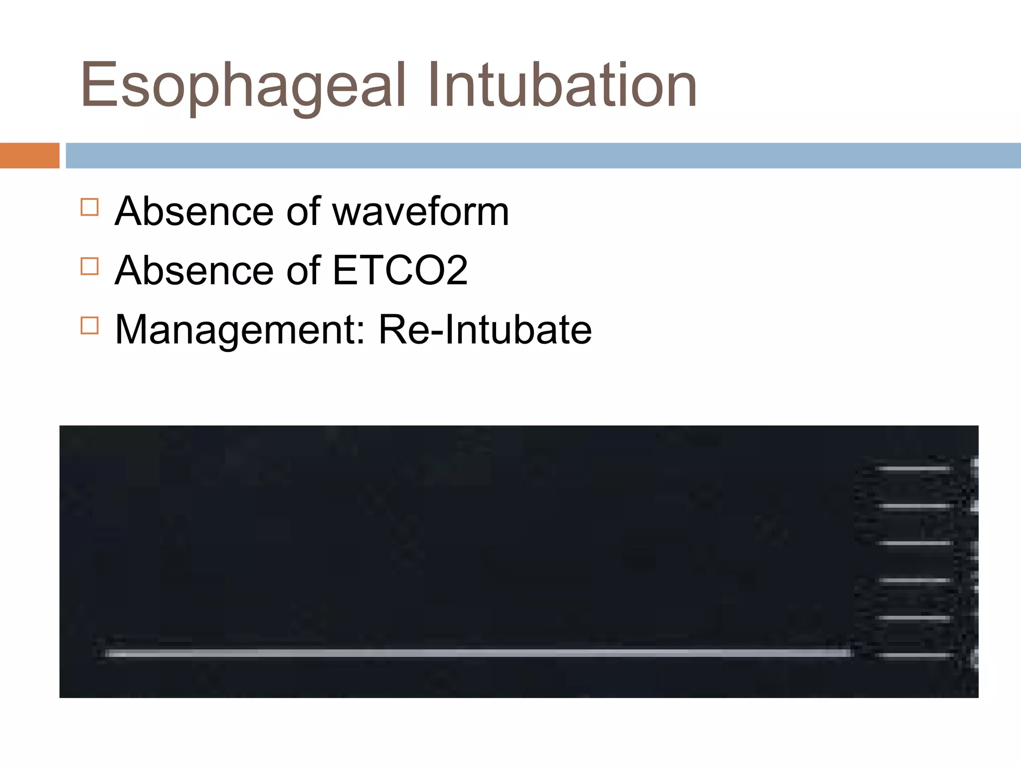 Etco2 in non-intubated patient: a must in ed | PPT