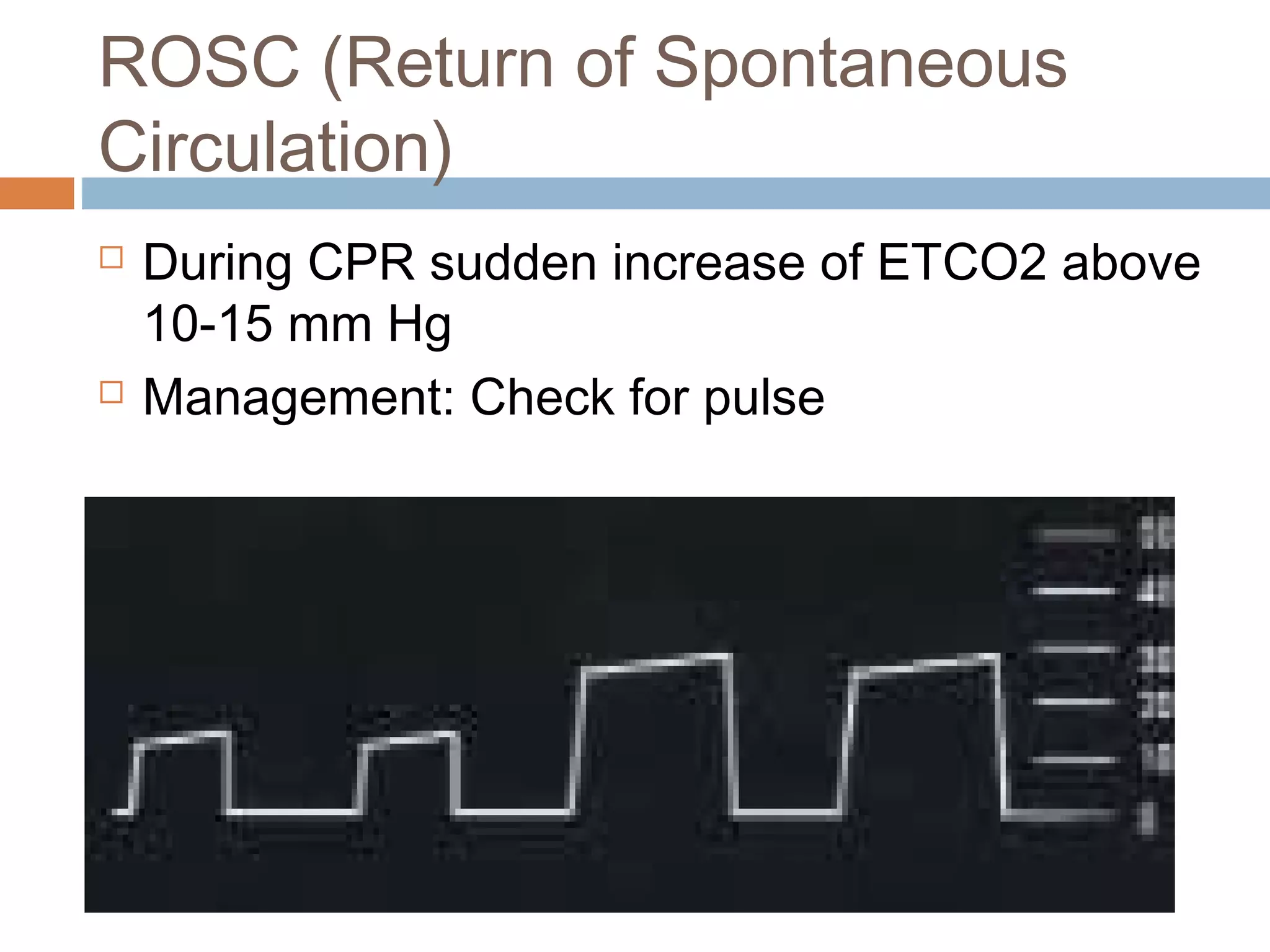 Etco2 in non-intubated patient: a must in ed | PPT