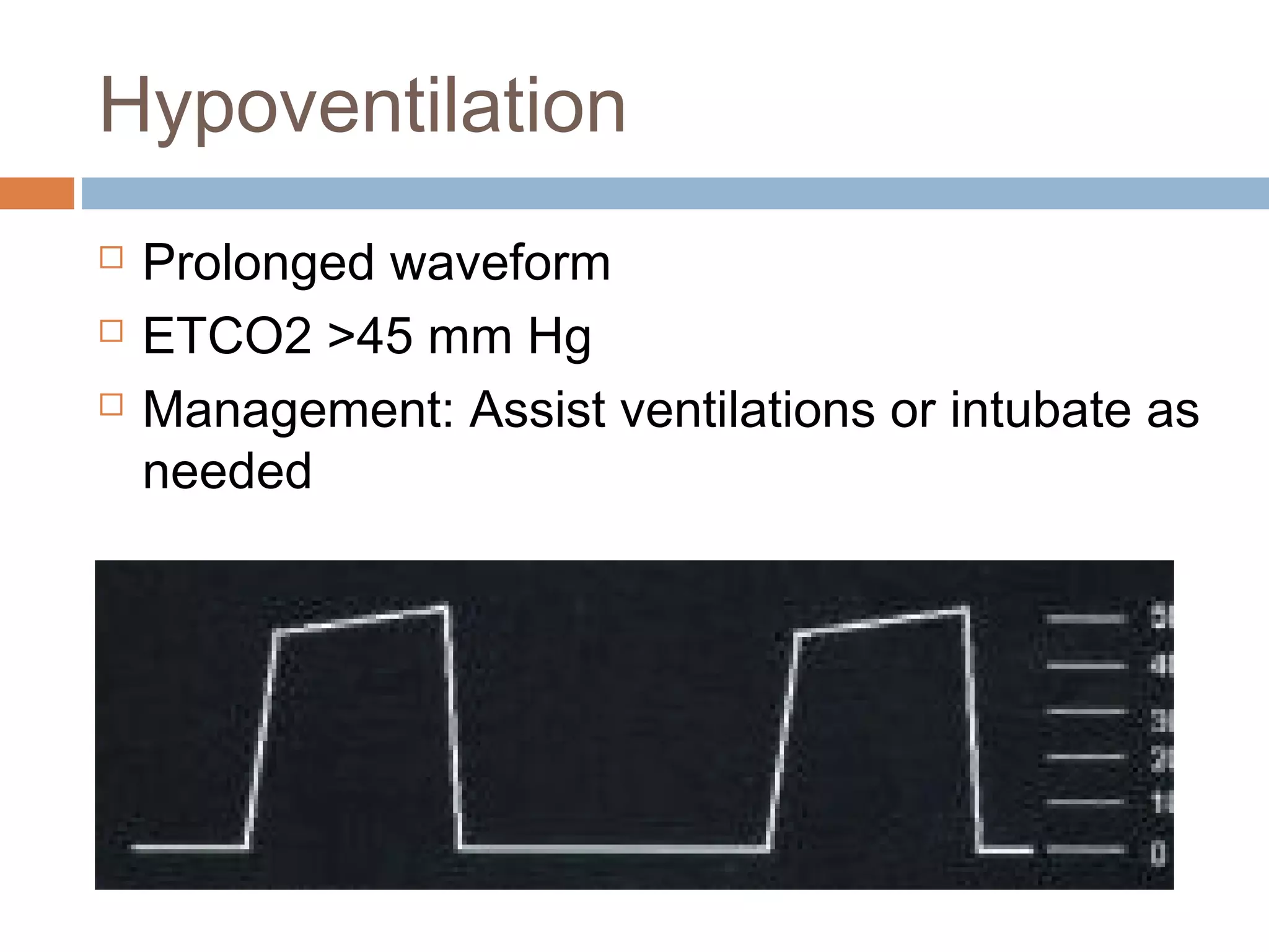 Etco2 in non-intubated patient: a must in ed | PPT