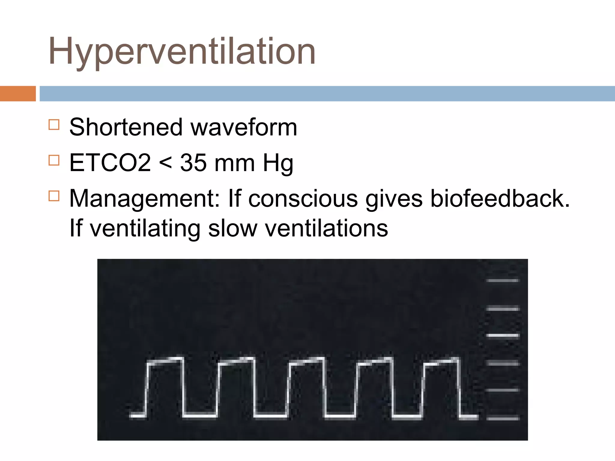 Etco2 in non-intubated patient: a must in ed | PPT