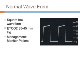 Etco2 in non-intubated patient: a must in ed | PPT