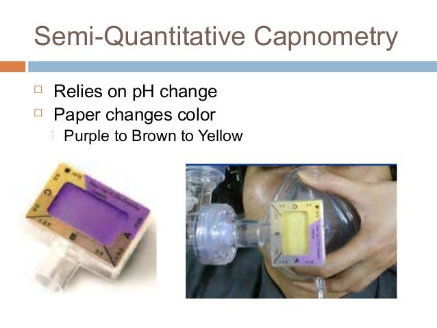 Etco2 in non-intubated patient: a must in ed