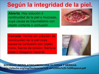 DR MIGUEL SEMINARIO HERIDAS, CICATRIZACION Y FASES MFPT I 2 AÑO.ppt