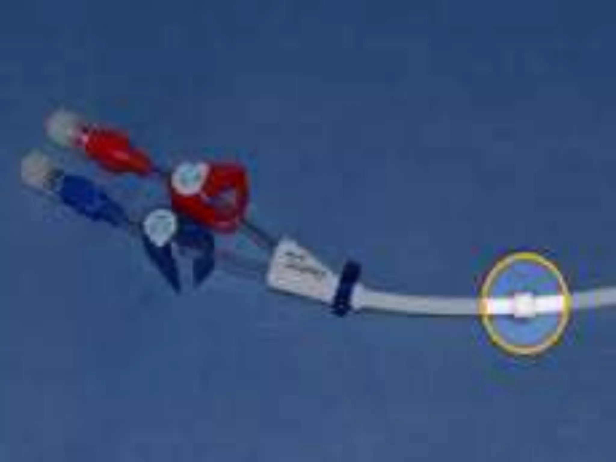 Dr mohammed abdelagawad hd catheter | PPTX