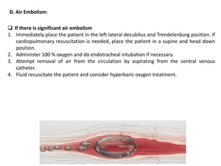 Dr mohammed abdelagawad hd catheter | PPTX