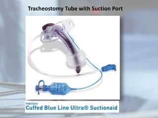 Tracheostomy - An Overview and Recent Concepts | PPTX
