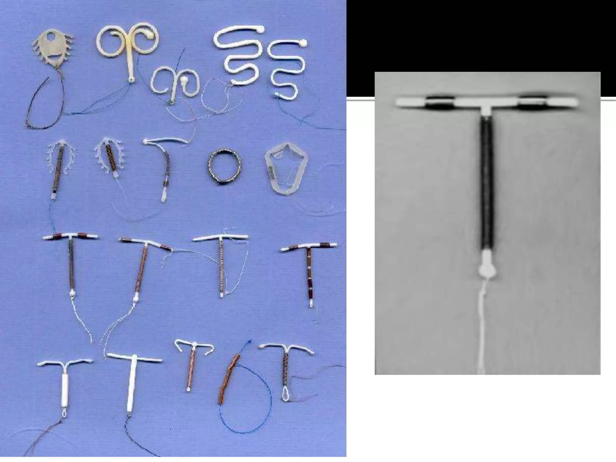 Drm science lecture 2 CONTRACEPTIVES AND IUDs | PPT