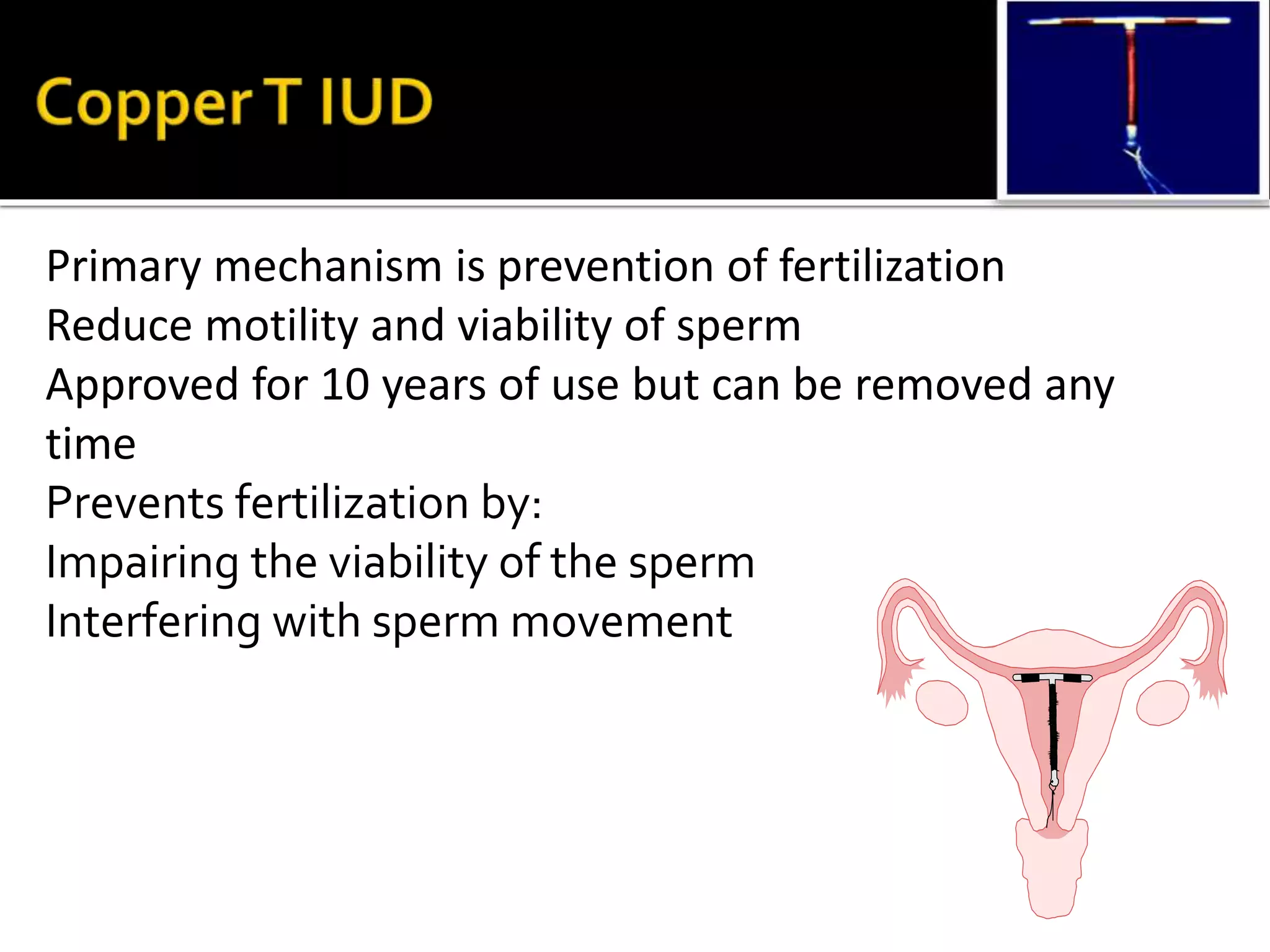 Drm science lecture 2 CONTRACEPTIVES AND IUDs | PPT