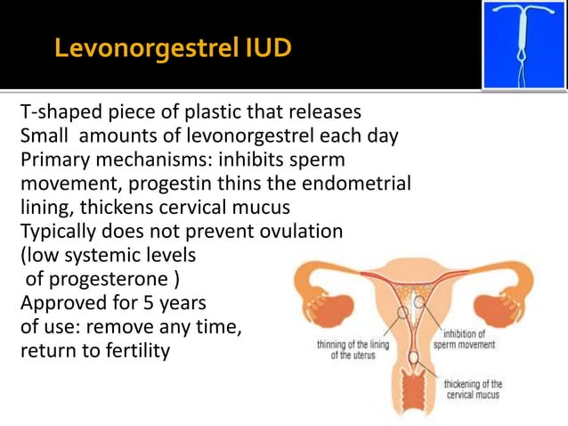 Drm science lecture 2 CONTRACEPTIVES AND IUDs | PPT