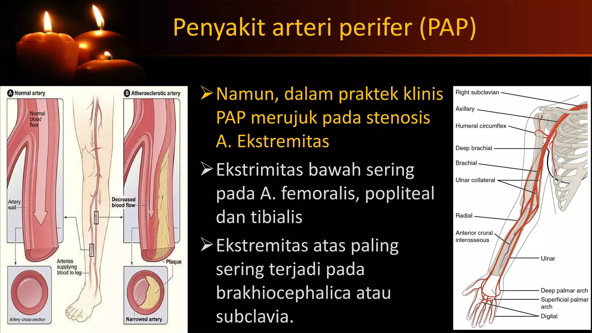 dr Muhammad Diah - Penyakit Arteri Perifer.pdf