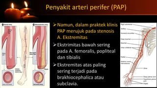 dr Muhammad Diah - Penyakit Arteri Perifer.pdf