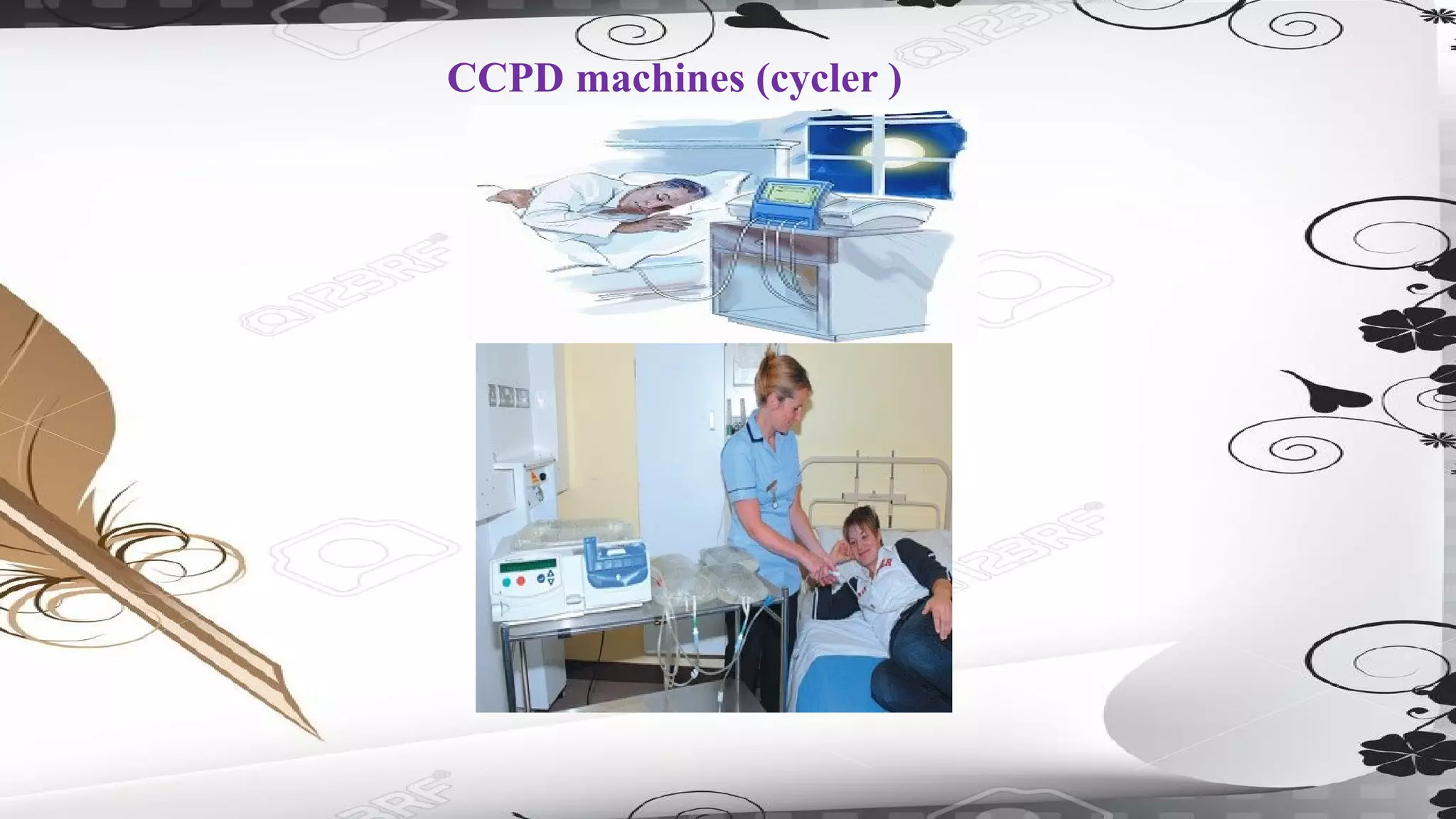 peritoneal dialysis in children | PDF