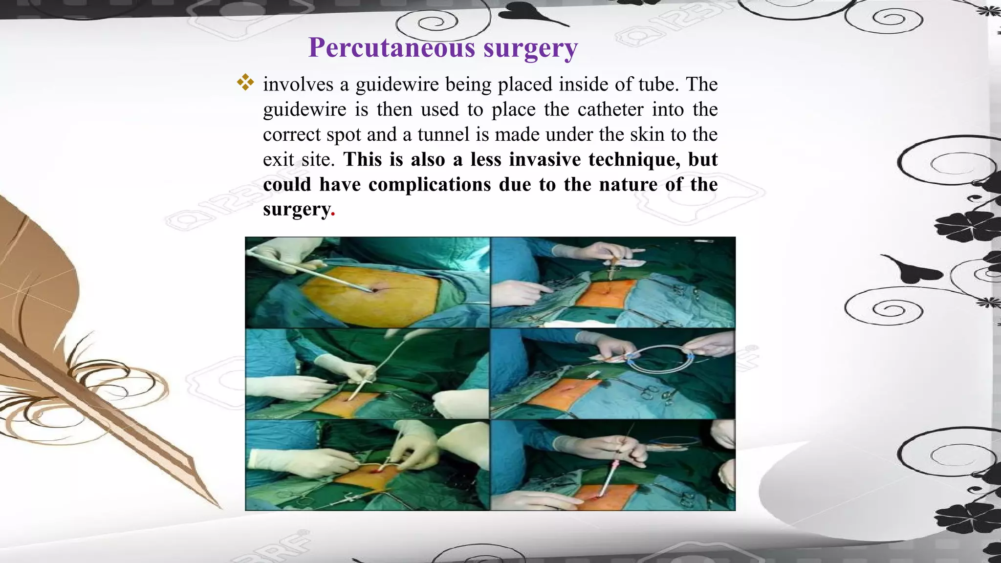 peritoneal dialysis in children | PDF