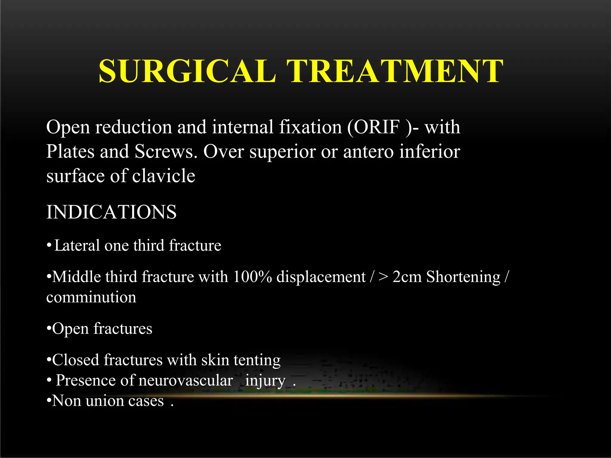 Dr Naveed clavicle fracture classification | PPTX
