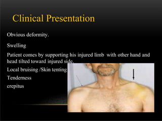 Dr Naveed clavicle fracture classification | PPTX