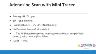 Dr nayana anaesthetic management of a case of dilated cardiomyopathy (1 ...