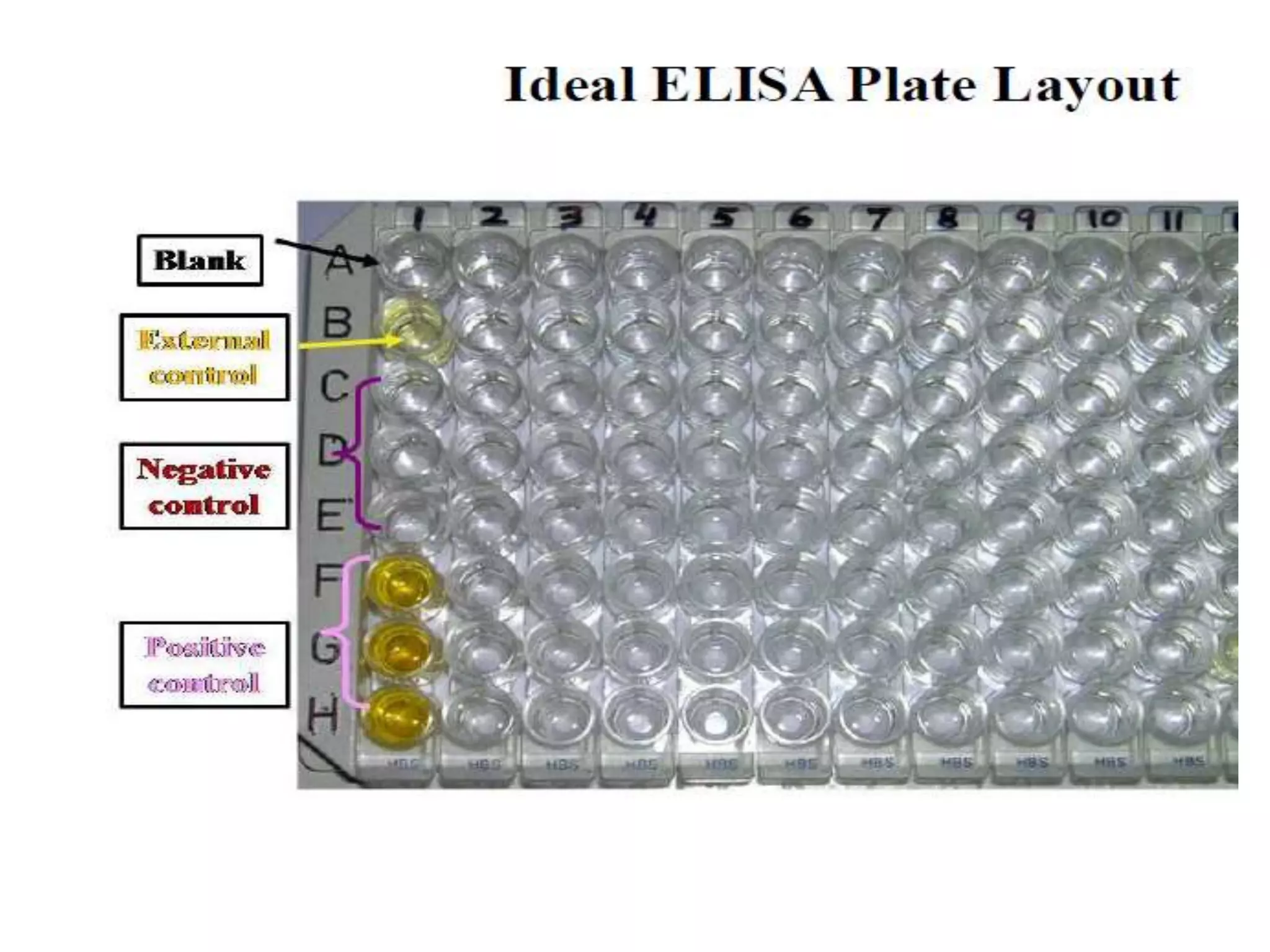 Transfusion tranmitted Infection- Testing platform& recommendations | PDF