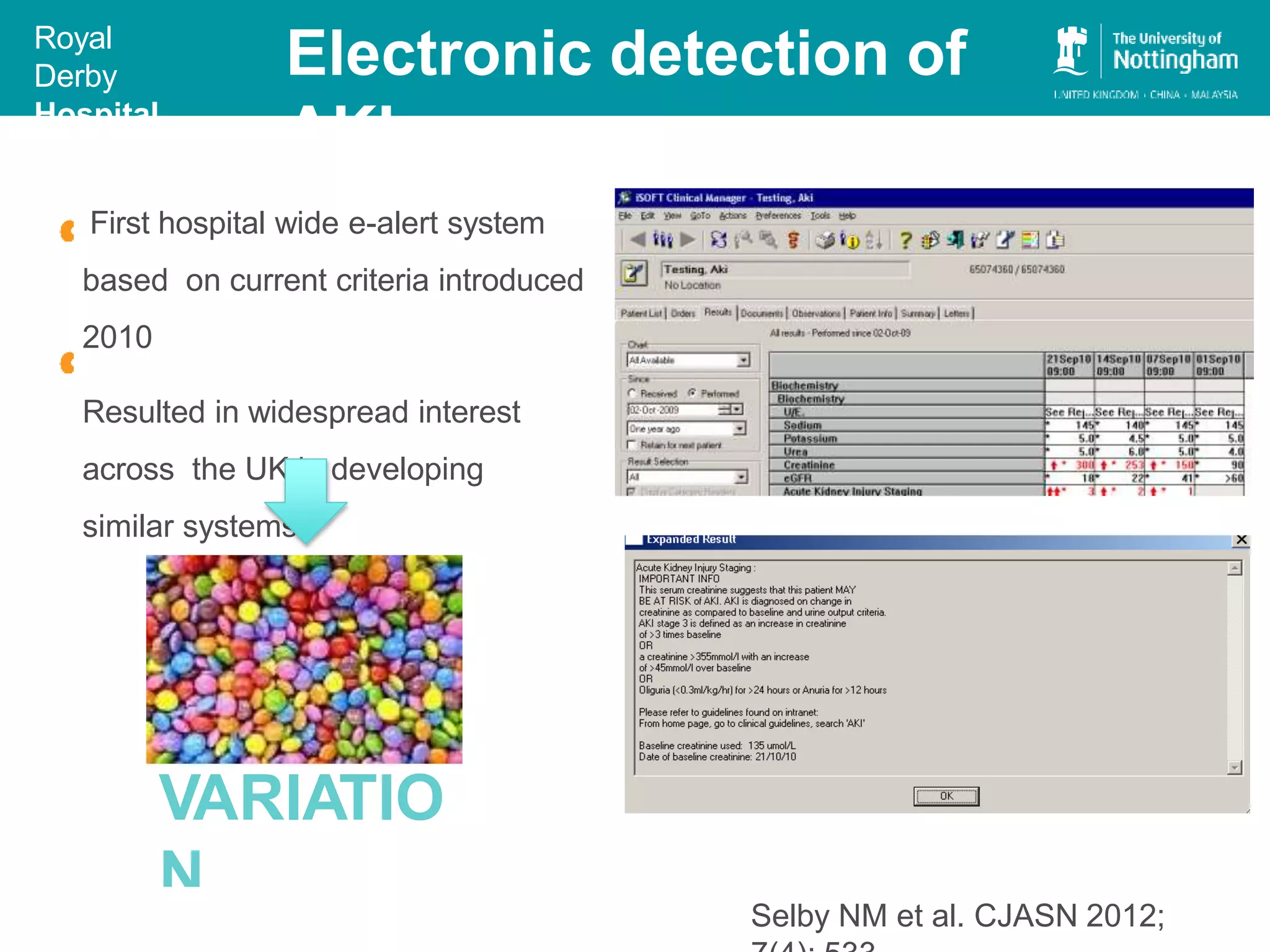 Dr Nick Selby - AKI detection, alerting and intervention-محول.pptx