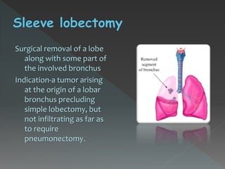 Surgical Management of Bronchogenic Carcinoma | PPTX | Lung and ...