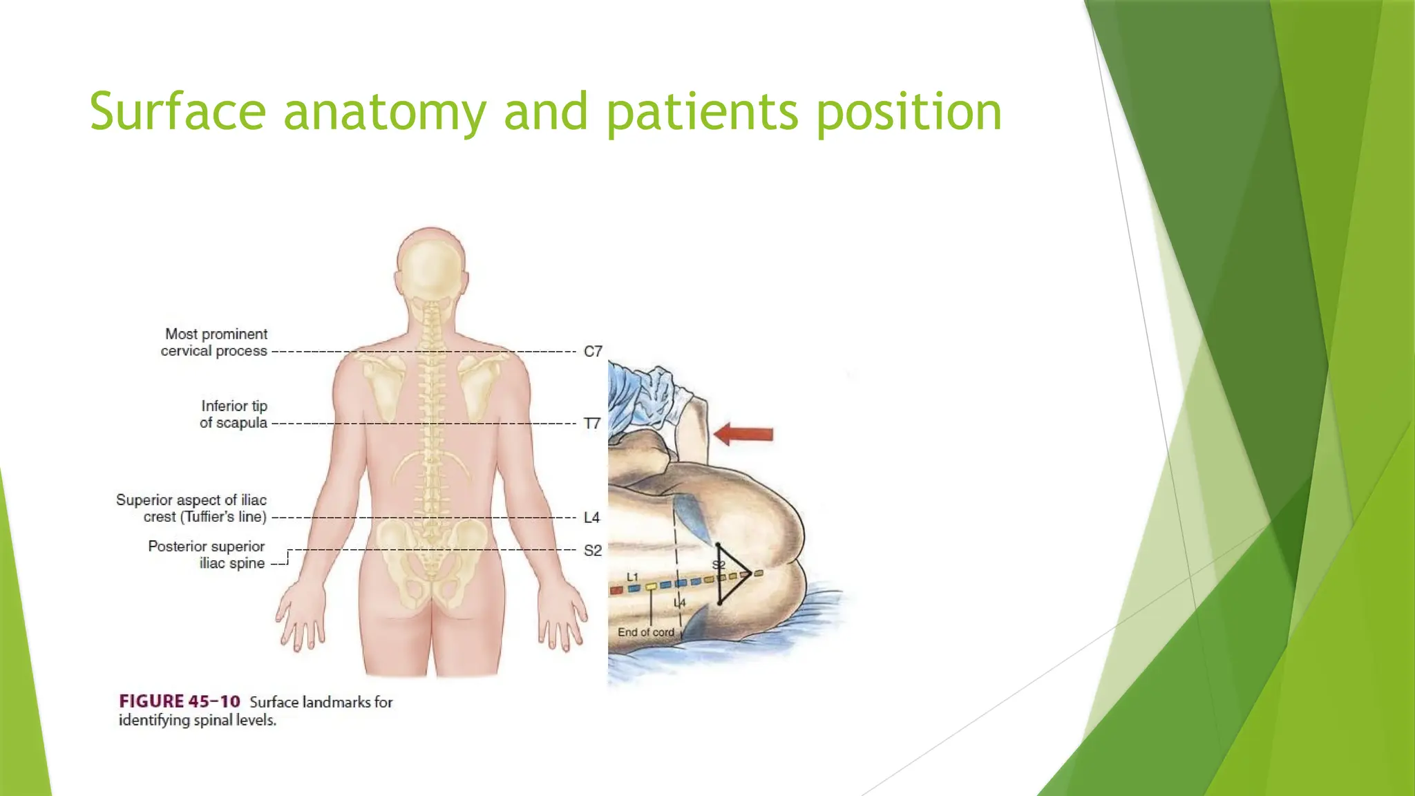 Healng of wound with Ayurvedic Managment | PPTX