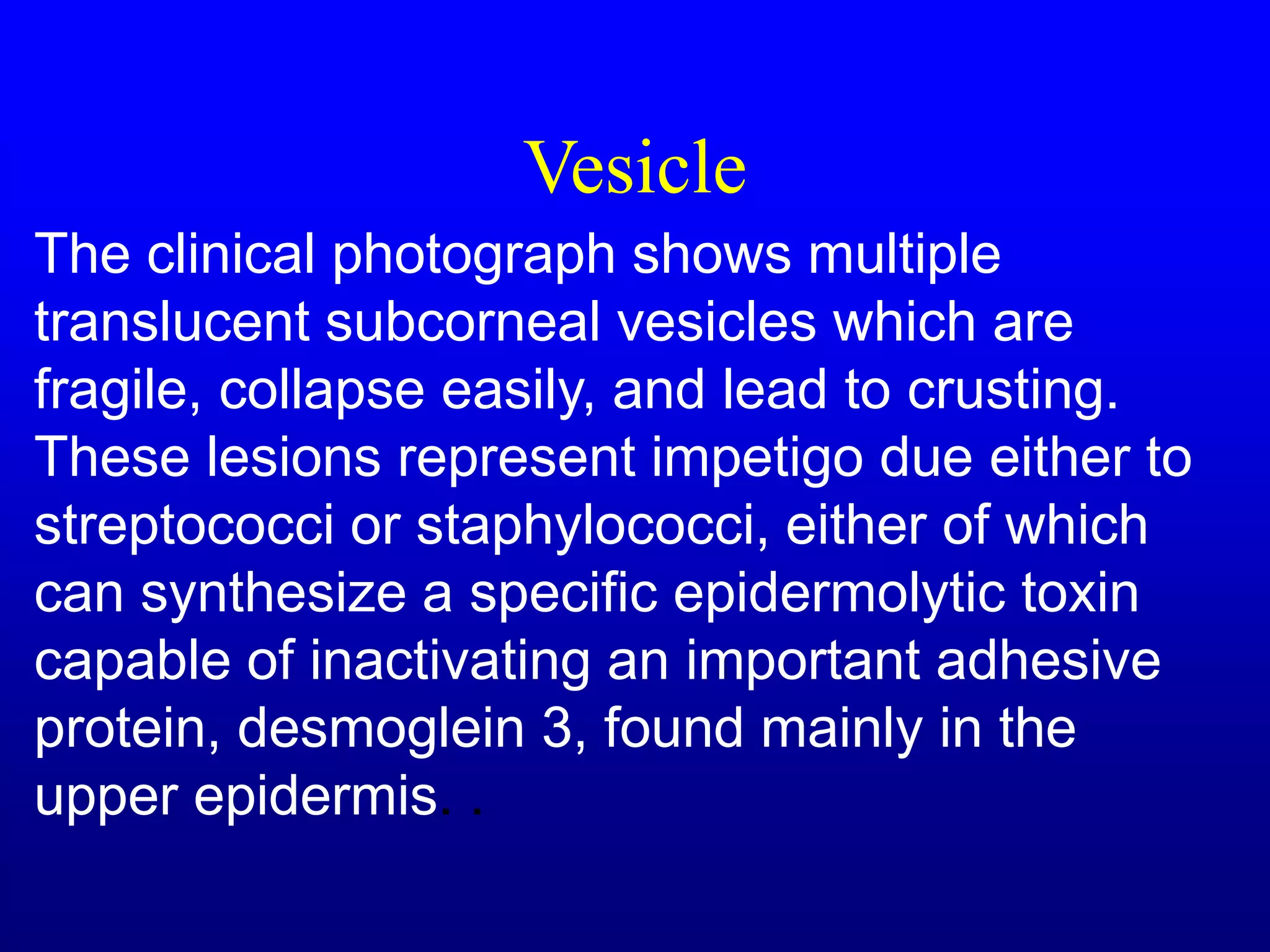 Dr Nzau Skin Lesions.ppt