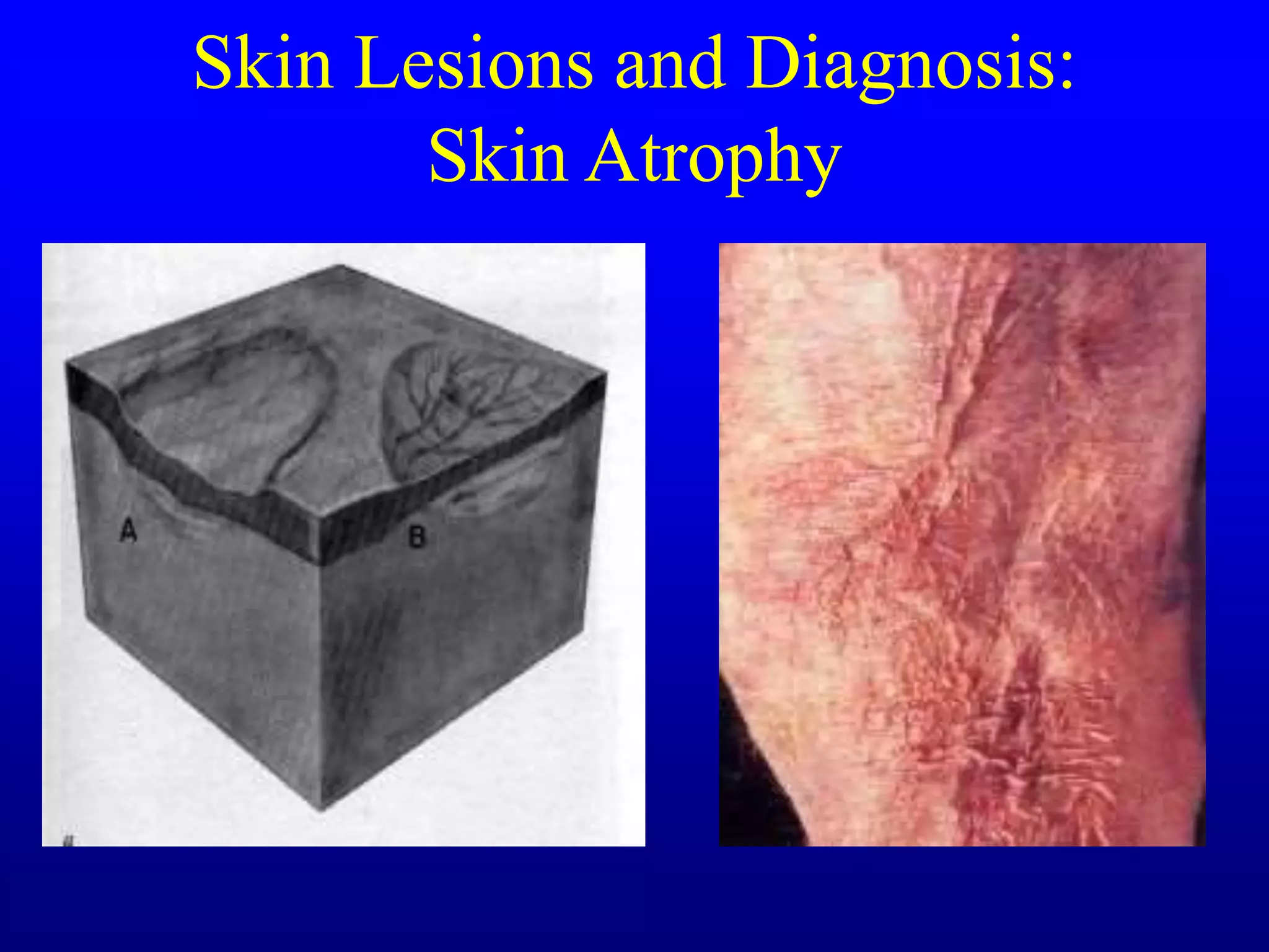 Dr Nzau Skin Lesions.ppt