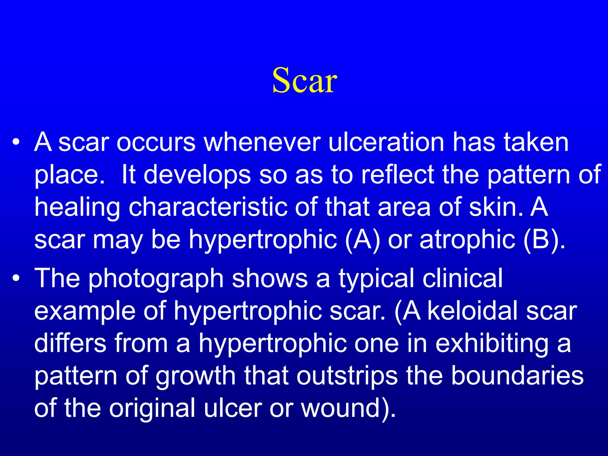 Dr Nzau Skin Lesions.ppt