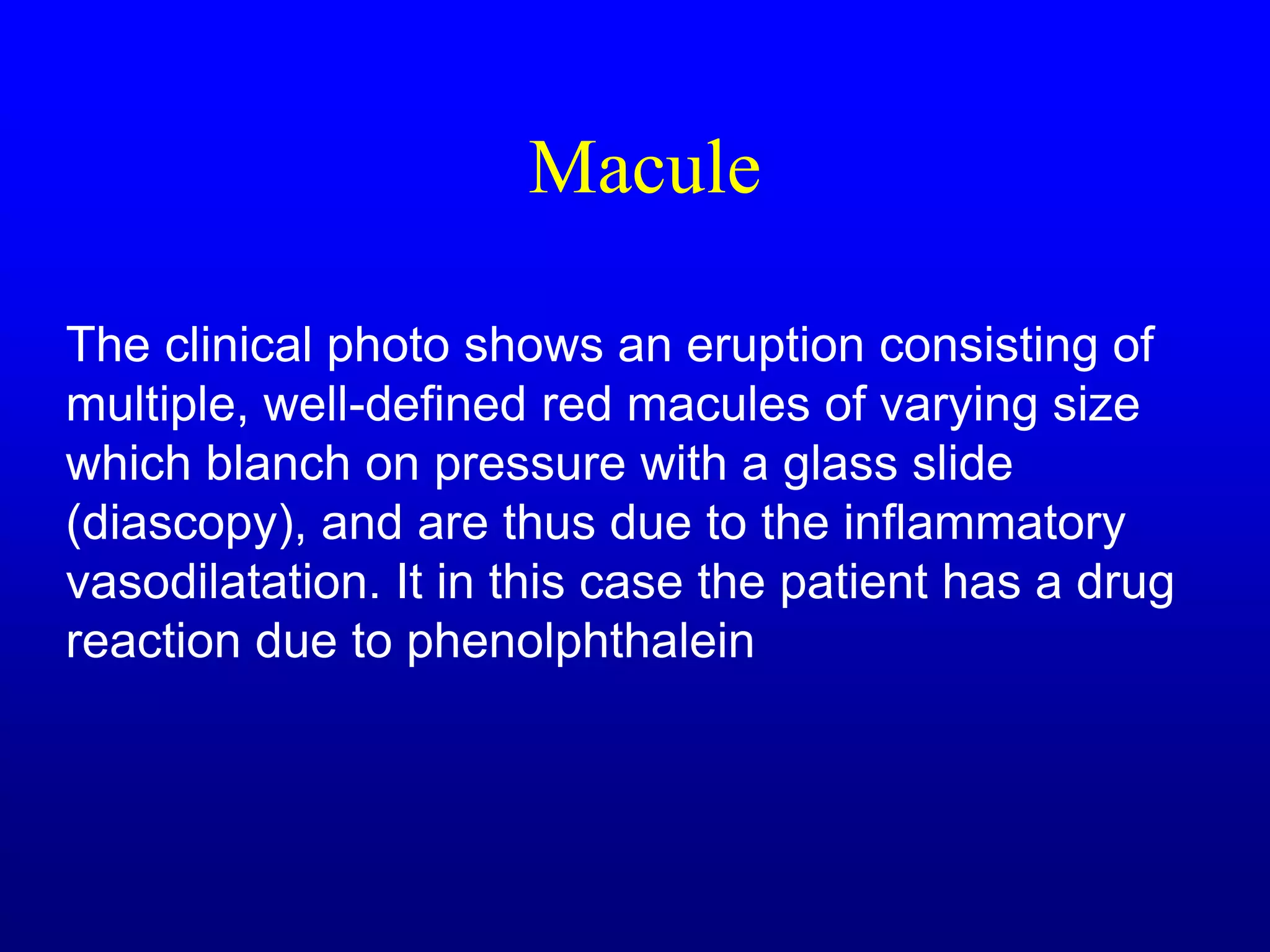 Dr Nzau Skin Lesions.ppt