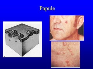 Dr Nzau Skin Lesions.ppt
