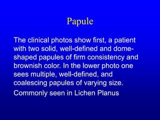 Dr Nzau Skin Lesions.ppt