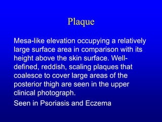 Dr Nzau Skin Lesions.ppt