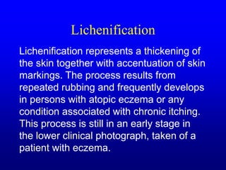 Dr Nzau Skin Lesions.ppt