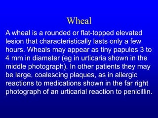 Dr Nzau Skin Lesions.ppt