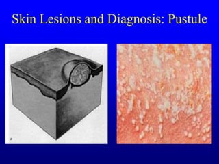 Dr Nzau Skin Lesions.ppt