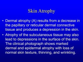 Dr Nzau Skin Lesions.ppt
