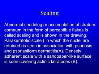 Dr Nzau Skin Lesions.ppt