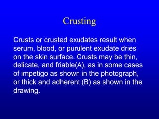 Dr Nzau Skin Lesions.ppt
