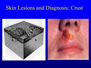 Dr Nzau Skin Lesions.ppt