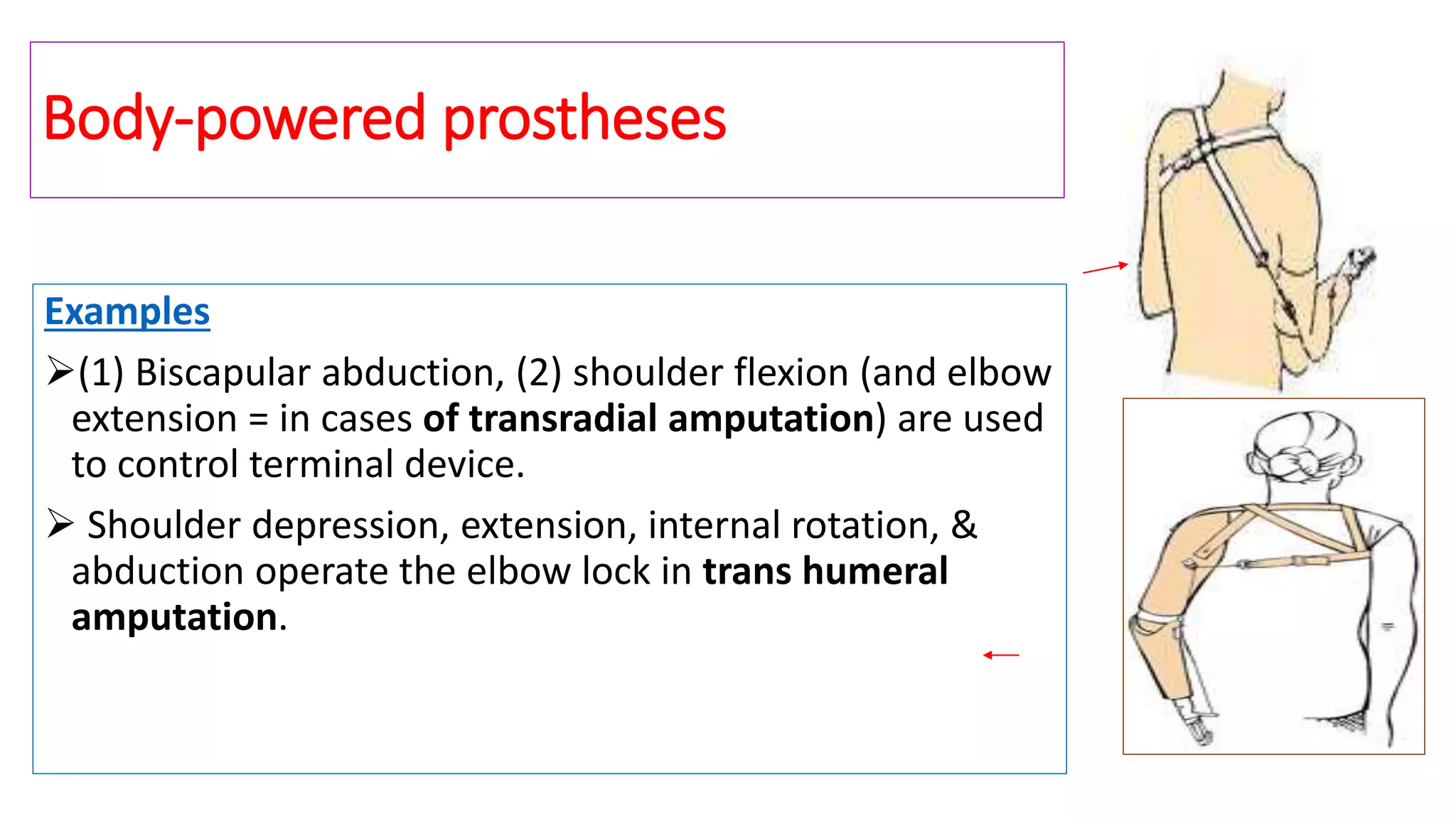 Upper Limb Prosthetics - Dr Om Prakash | PPTX