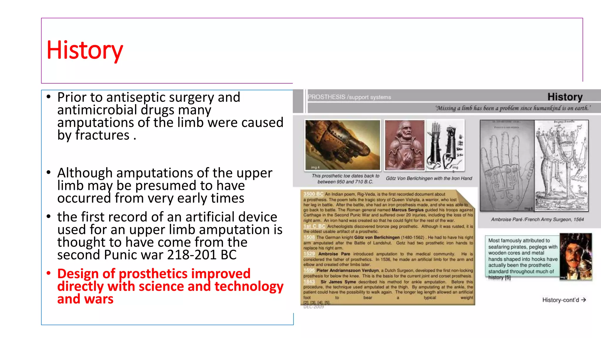 Upper Limb Prosthetics - Dr Om Prakash | PPTX