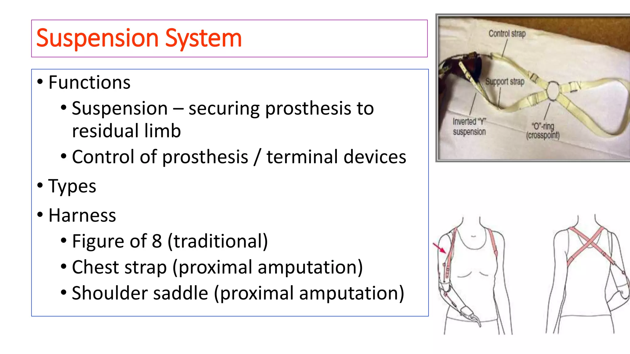 Upper Limb Prosthetics - Dr Om Prakash | PPTX
