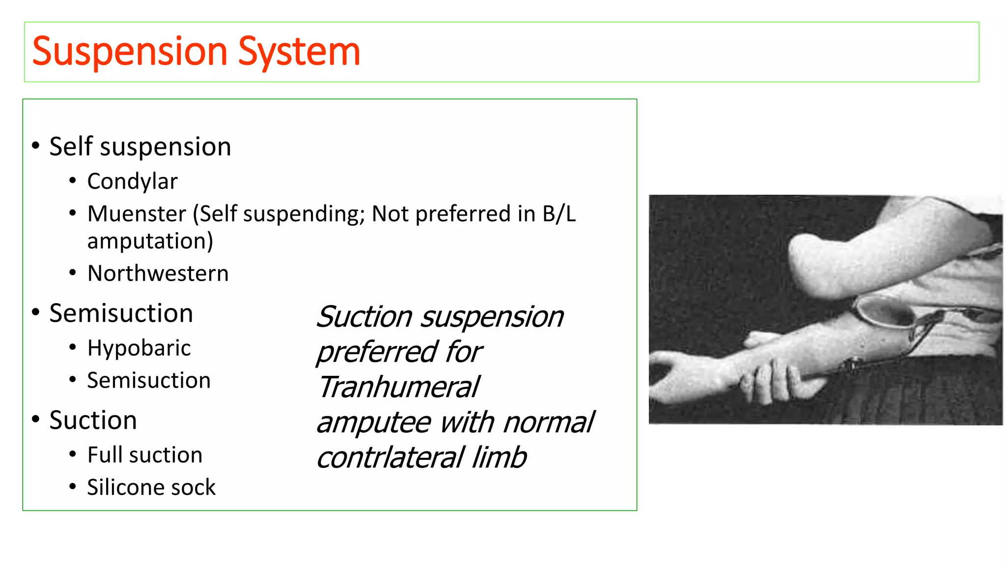 Upper Limb Prosthetics - Dr Om Prakash | PPTX
