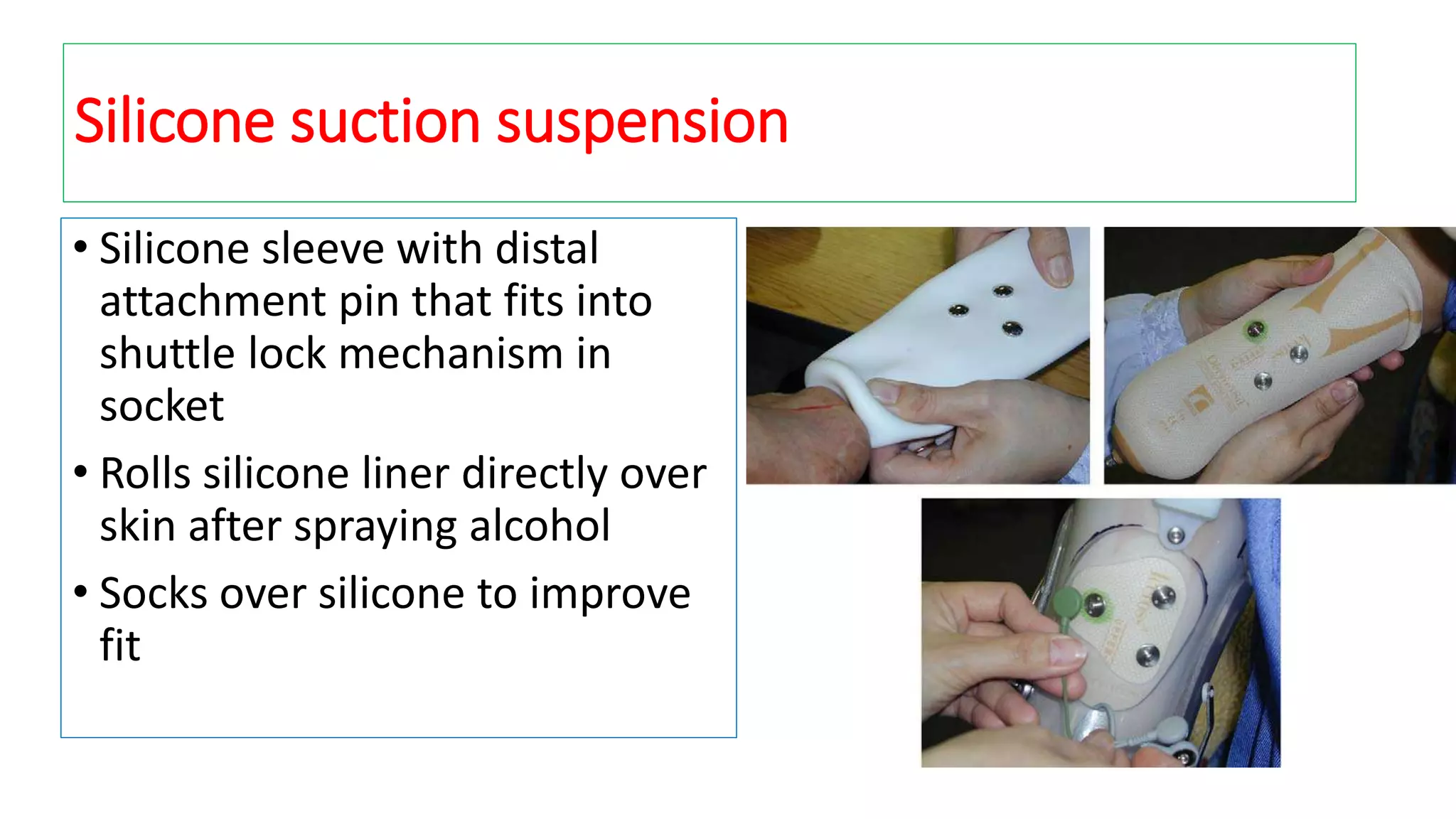 Upper Limb Prosthetics - Dr Om Prakash | PPTX | Physical Therapy | Wellness