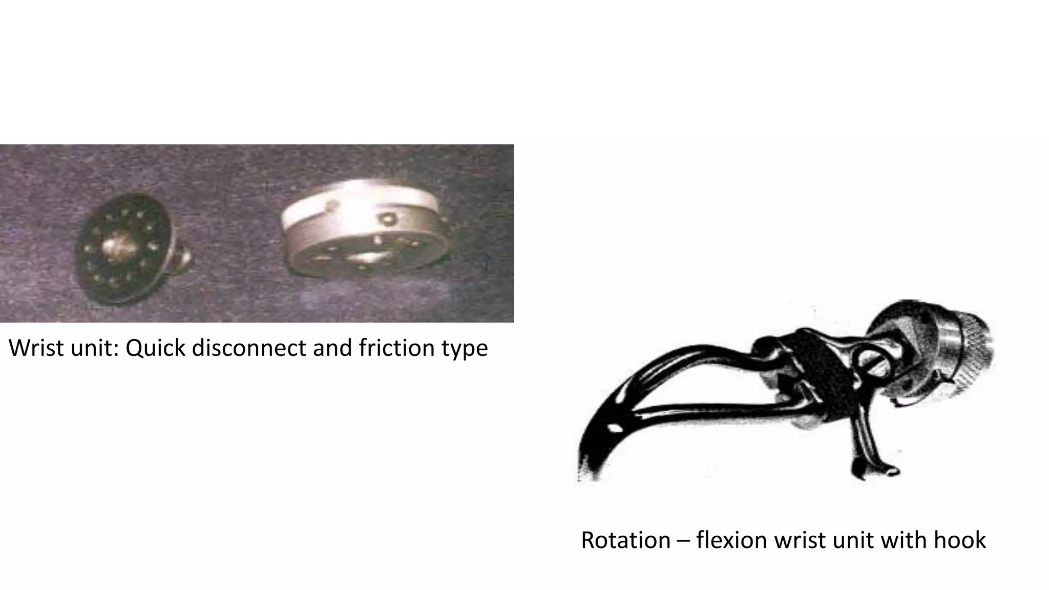 Upper Limb Prosthetics - Dr Om Prakash | PPTX