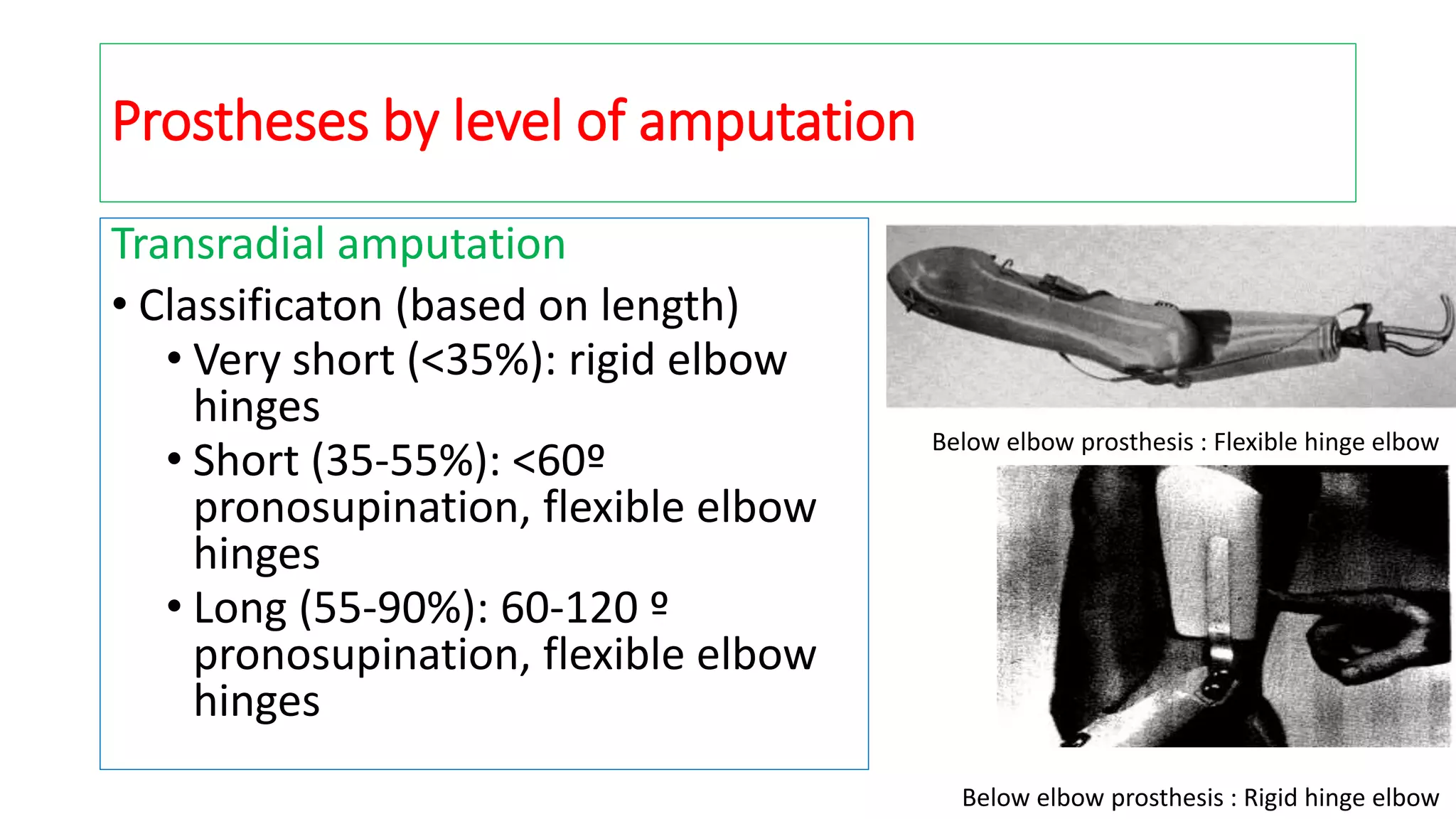 Upper Limb Prosthetics - Dr Om Prakash | PPTX