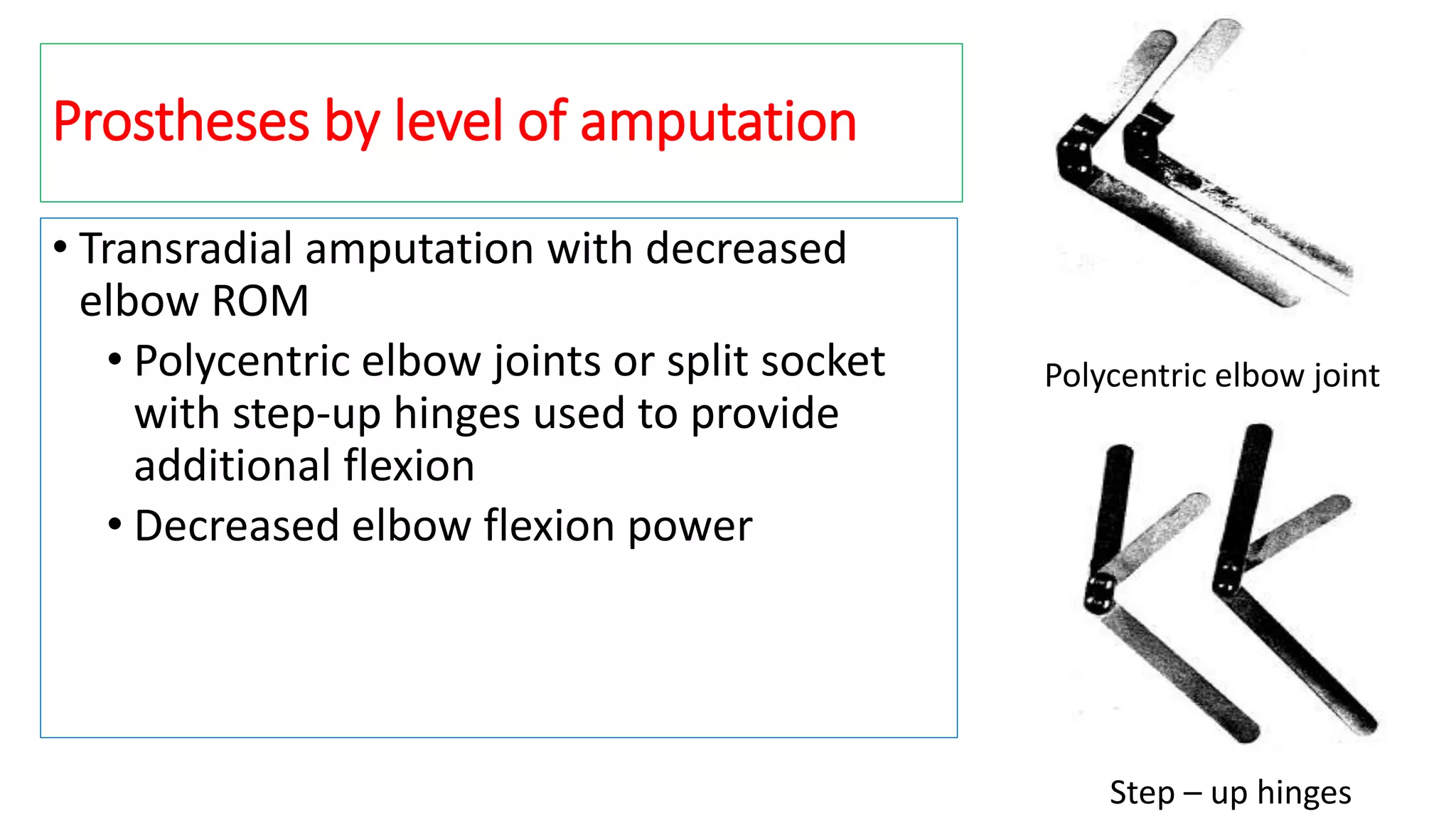Upper Limb Prosthetics - Dr Om Prakash | PPTX
