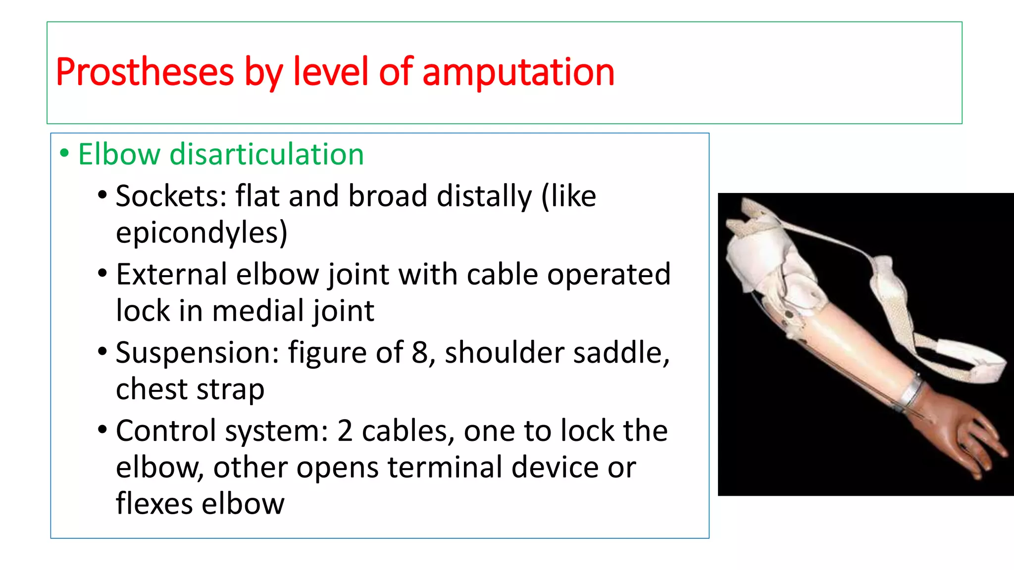 Upper Limb Prosthetics - Dr Om Prakash | PPTX